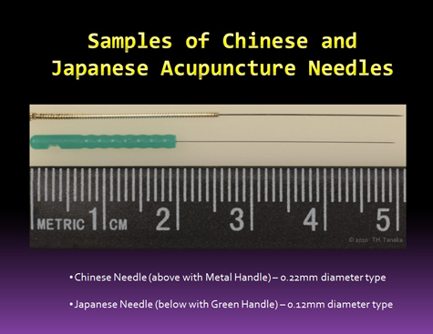 Acupuncture Styles and Techniques | Japanese & Chinese Acupuncture